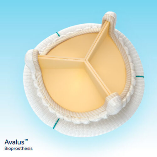 Mechanical ATS Open Pivot Aortic and Mitral Valves. – Arcos Biomedical