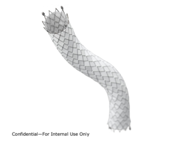 Stent fluency – Arcos Biomedical